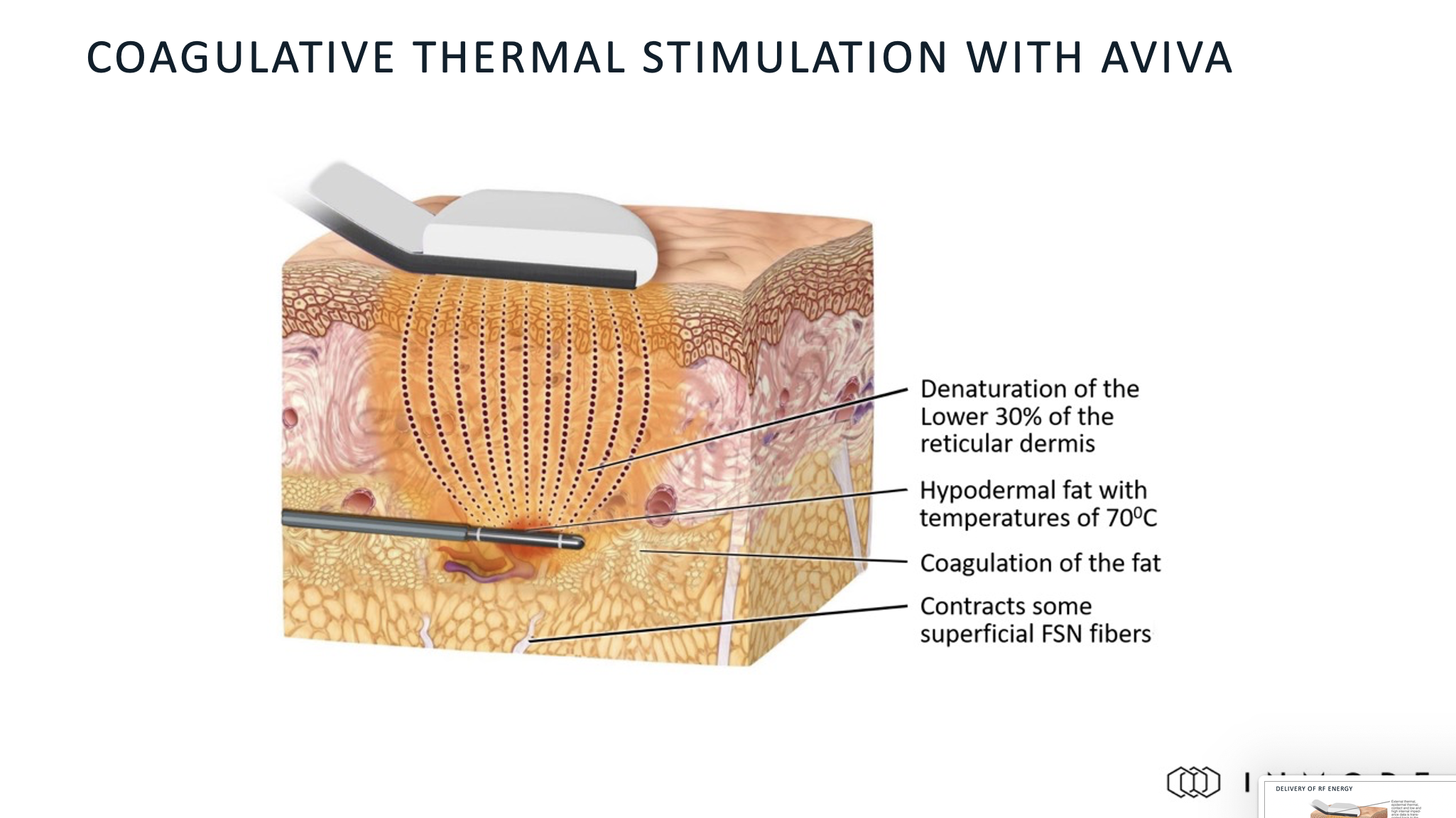 Empower RF - Morpheus8V, VTone, FormaV, Aviva — The Door W4