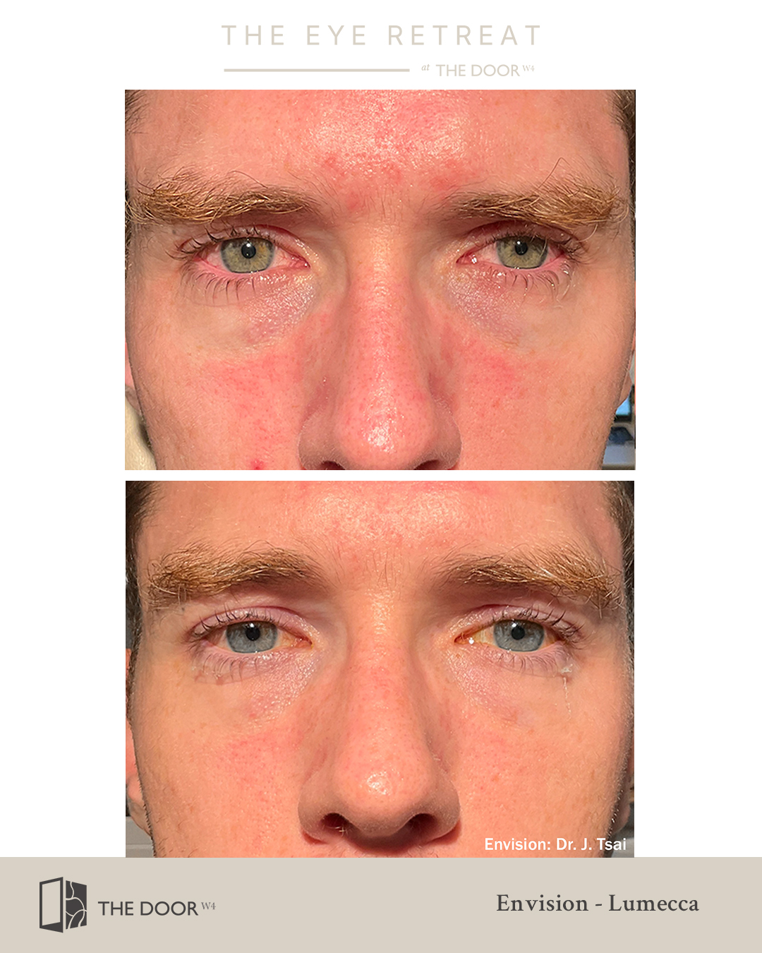 The Eye Retreat by Sharon Flora — The Door W4