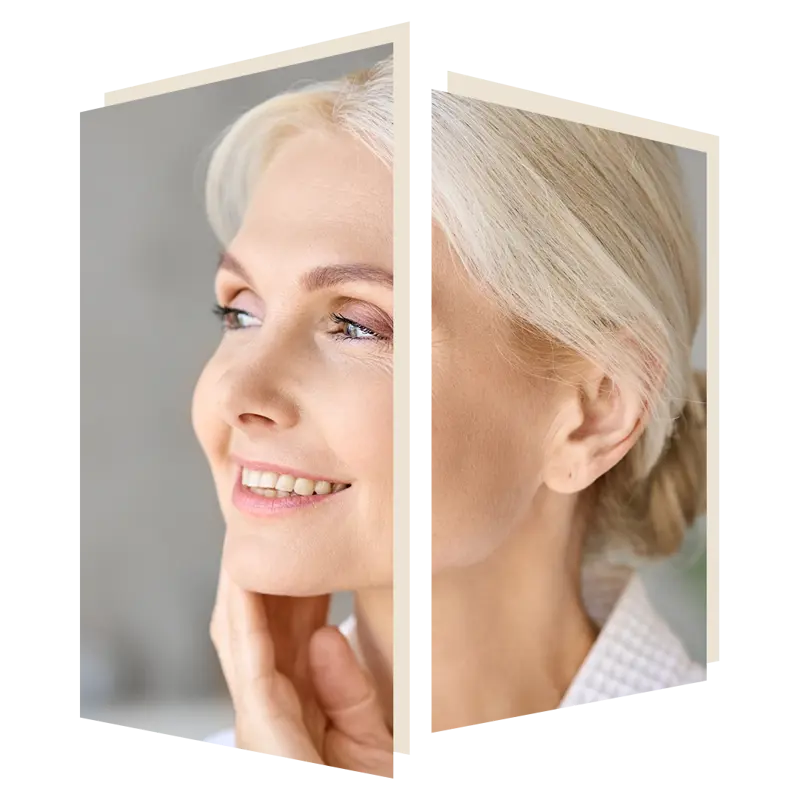 FaceTite — The Door W4