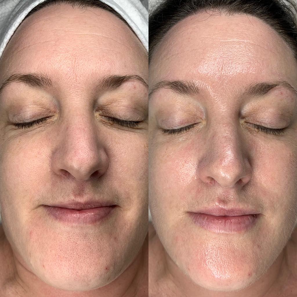 Lift and Glow Facial — The Door W4