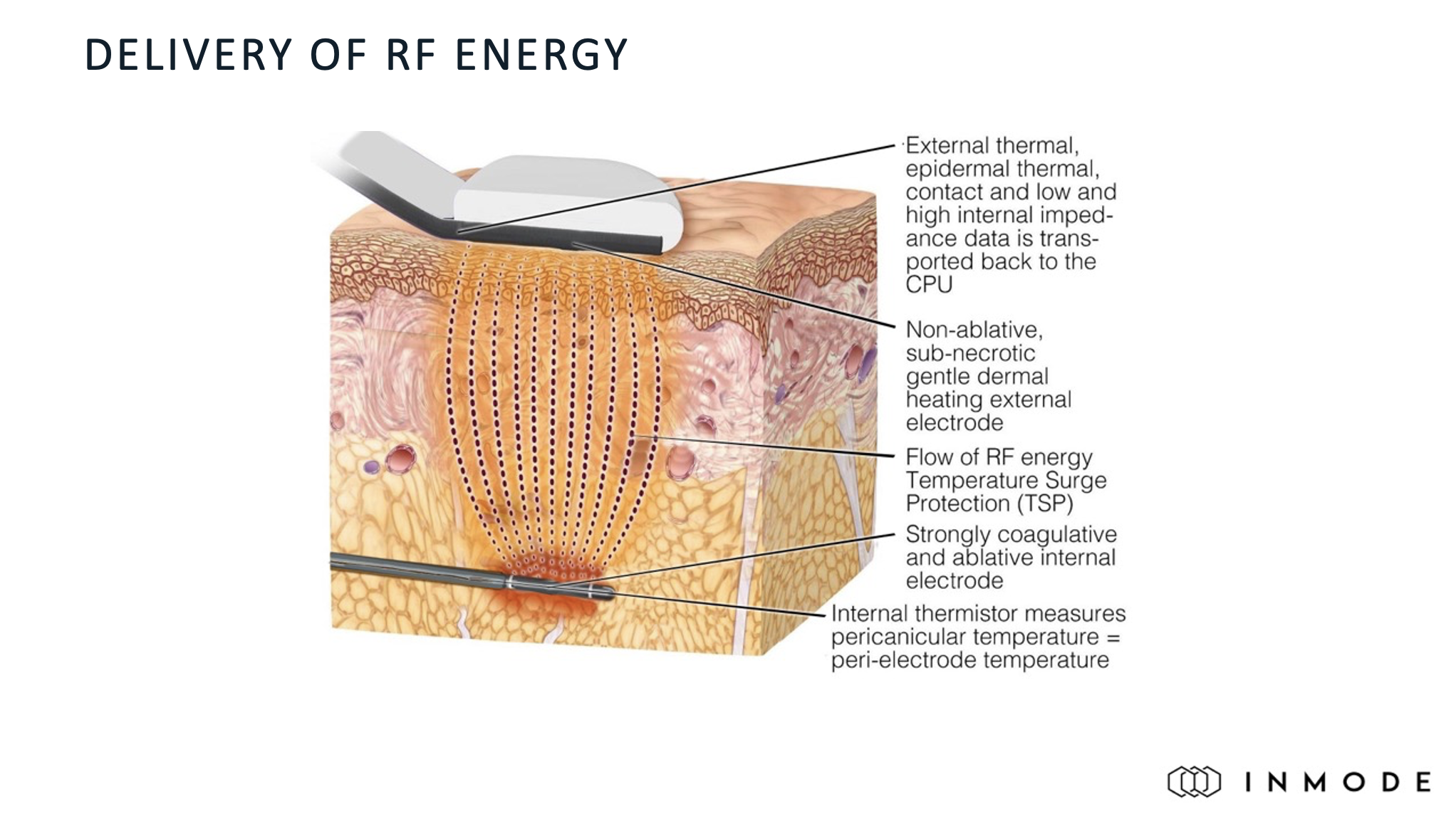 Empower RF - Morpheus8V, VTone, FormaV, Aviva — The Door W4