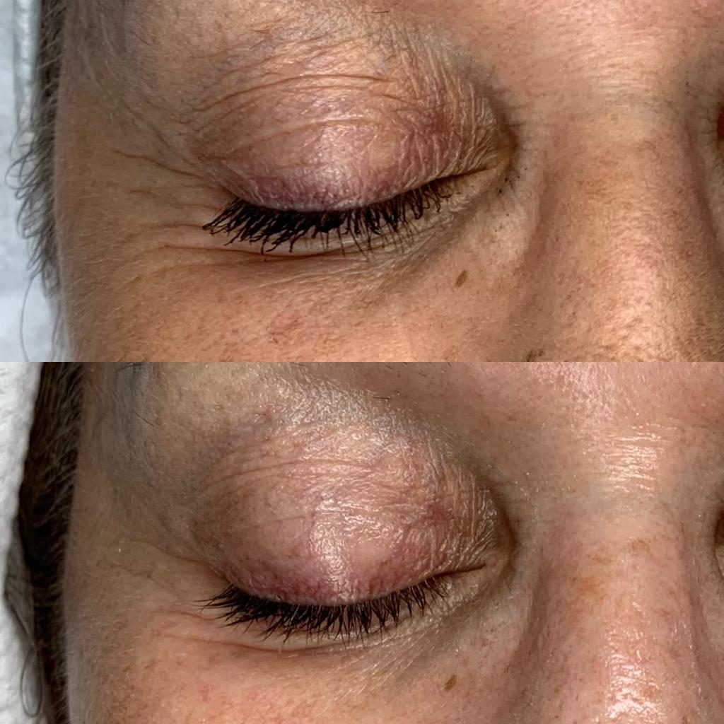 The SkinFit Programme — The Door W4