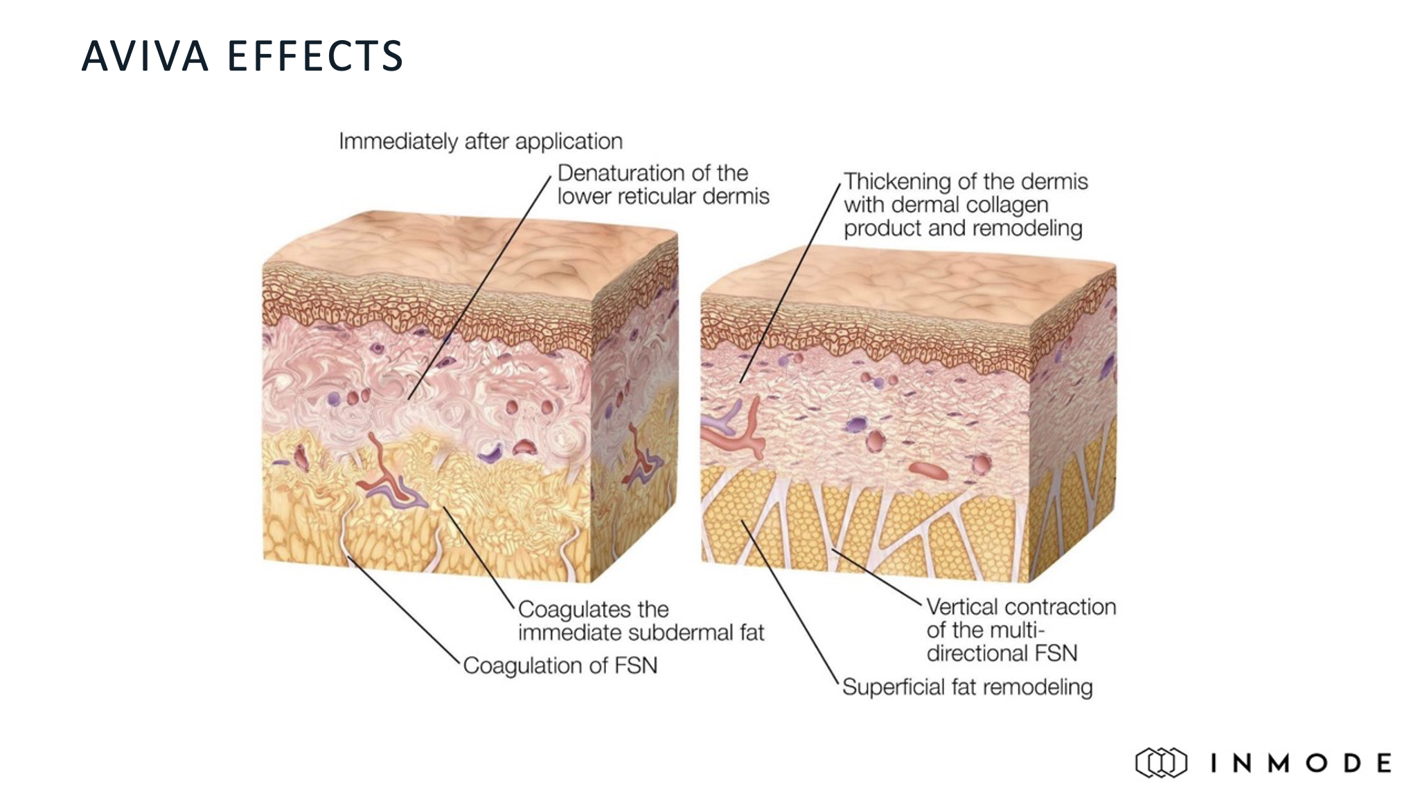 Empower RF - Morpheus8V, VTone, FormaV, Aviva — The Door W4