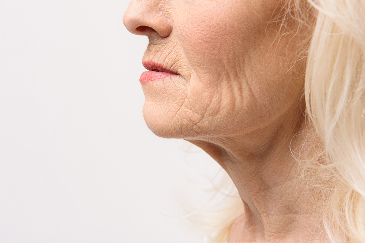 Loose Sagging Skin — The Door W4