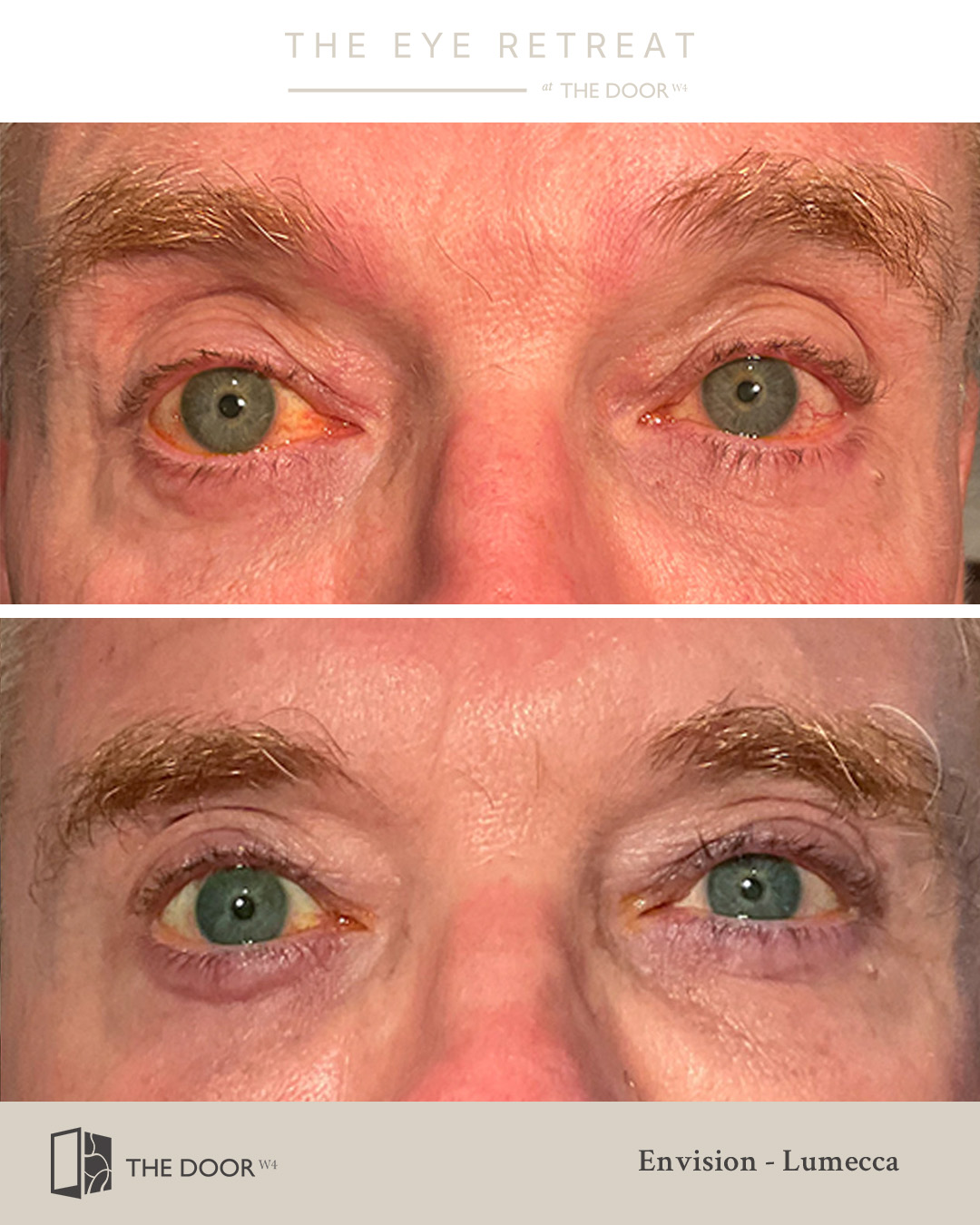 The Eye Retreat by Sharon Flora — The Door W4