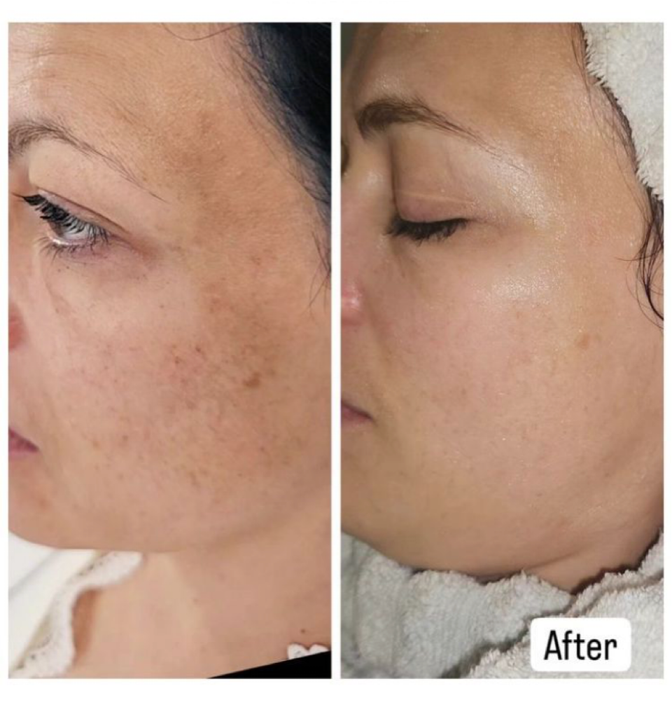 Infusion Lab Facial — The Door W4