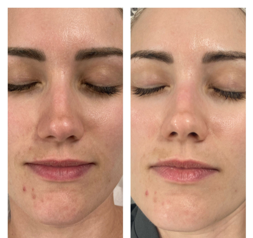 Infusion Lab Facial — The Door W4