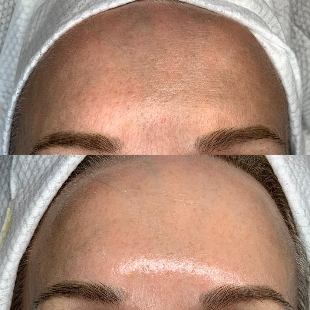 The SkinFit Programme — The Door W4