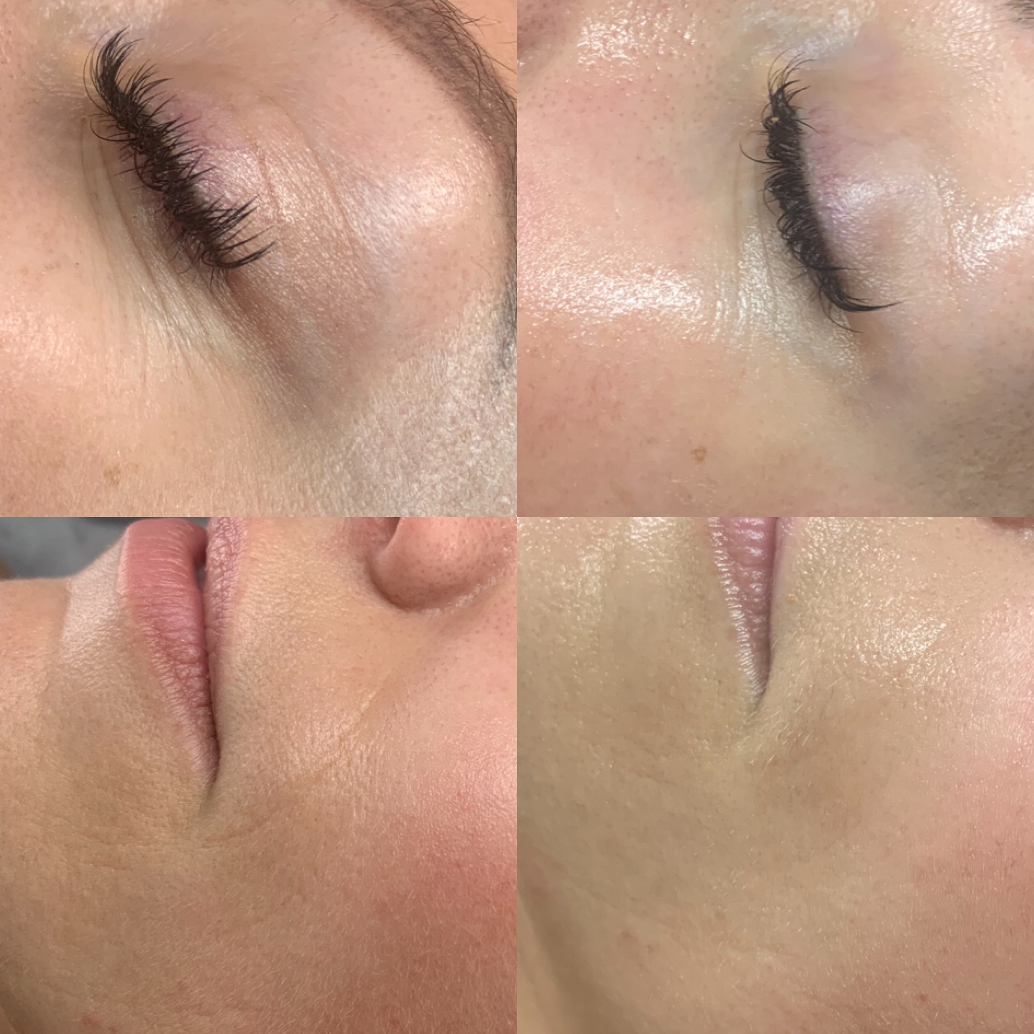 Lift and Glow Facial — The Door W4